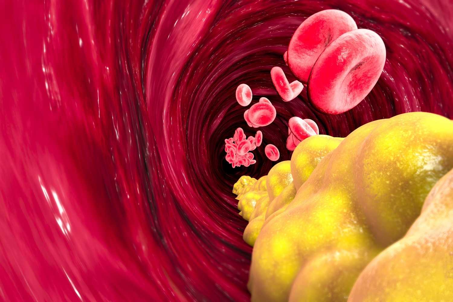 Lipid Day | Holiday Smart
